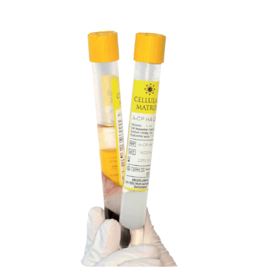 Epruvetë Cellular Matrix PRP me hialuron - Ortopedike :: Медикус Хелп ...